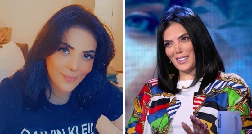 صور حورية فرغلي قبل وبعد نجاح عمليات تجميل أنفها الأخيرة مجلة هي